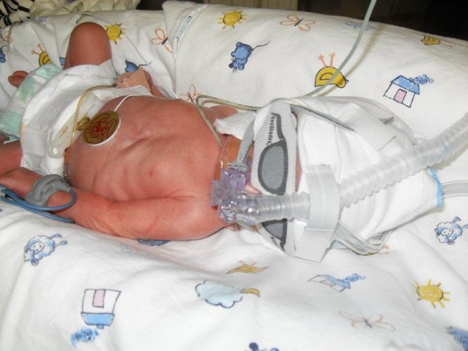 Why NICU Awareness month is important to me! | The Citizen