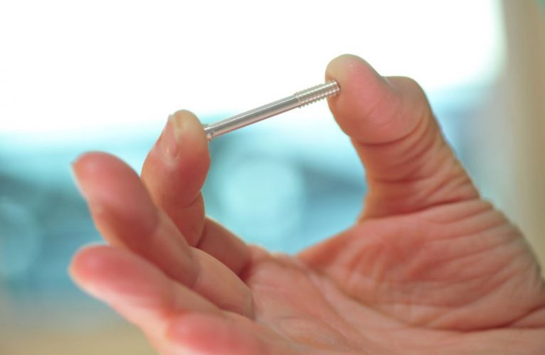 Mending broken bones just got a lot easier | The Citizen