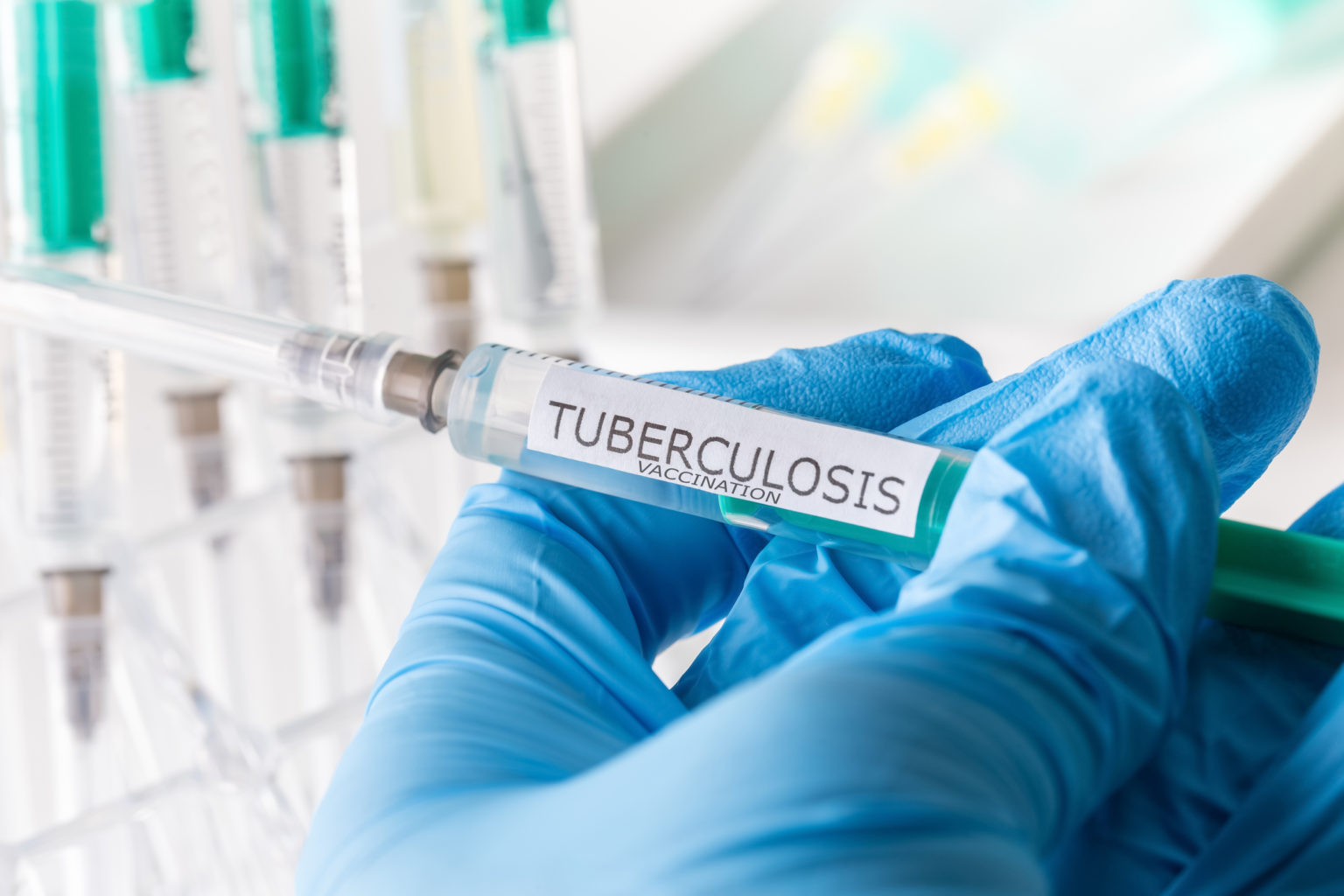 Breathing spreads tuberculosis bacteria, research suggests | The Citizen