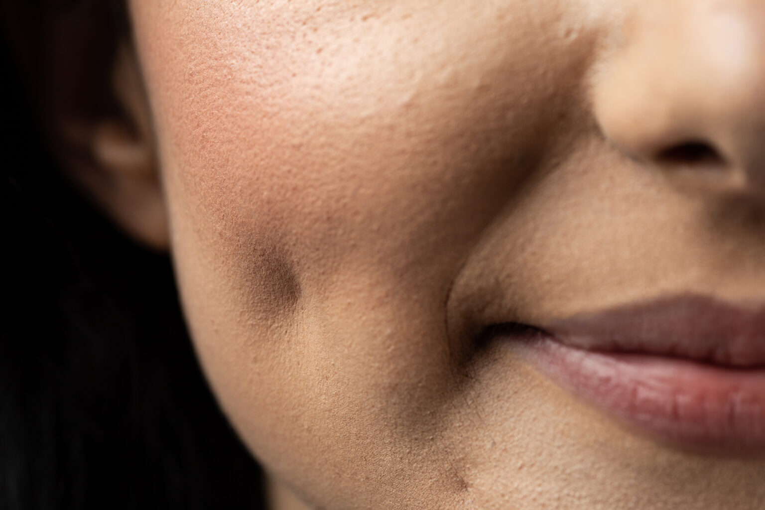 Can you create fake dimples without going under the knife?