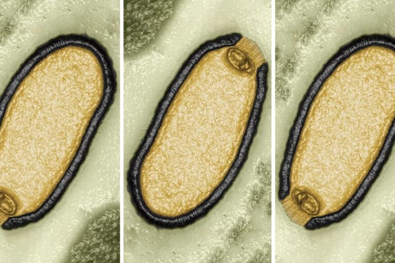 Thawed 50 000-year-old zombie virus poses health threat