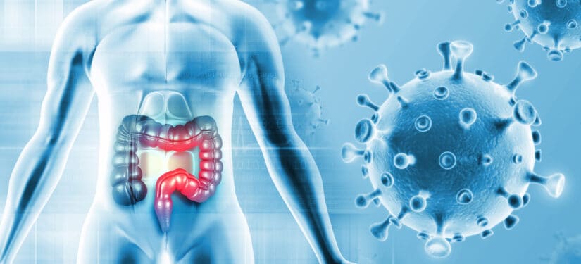 Colon cancer: symptoms, causes and treatment