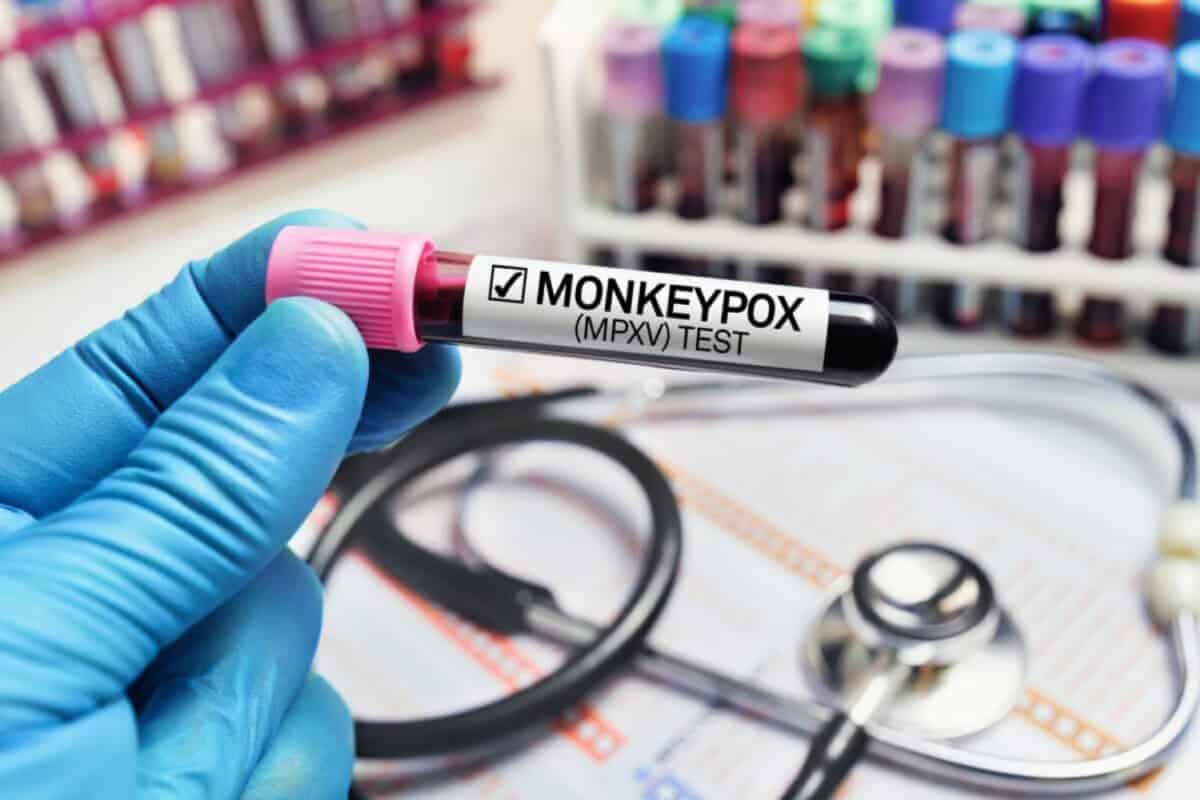 Monkeypox update: Man with travel history to Peru, one of two new cases ...