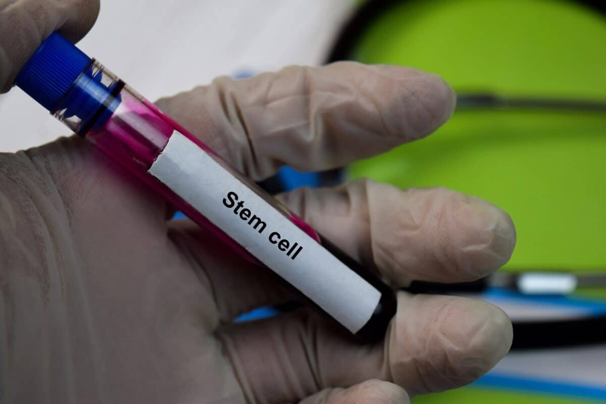 Stem Cell Donor Needed for Young Lives at Risk | The Citizen